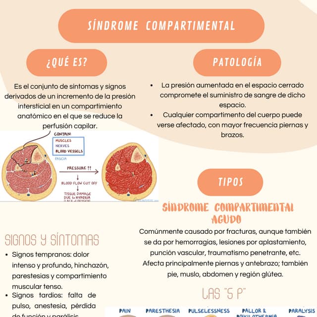 Síndrome compartimental | PDF