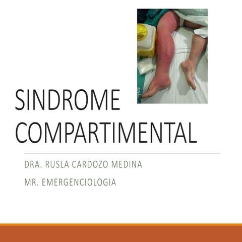 sindrome compartimental.pptx