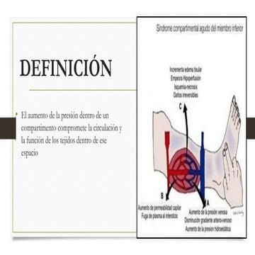 Sindrome compartimental de miembros Superiores y miembros inferiores | PPTX