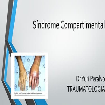Sindrome_Compartimental concepto y tipos | PDF
