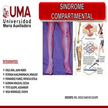 SINDROME COMPARTIMENTAL GRUPO 07 FINAL.pptx