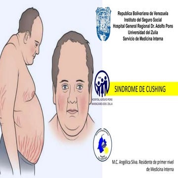 Síndrome de Cushing: causas, síntomas y tratamiento | PPT