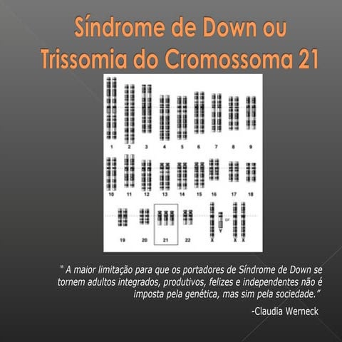 Sindrome de down_ou_trissomia_de_cromossoma_21 | PPT