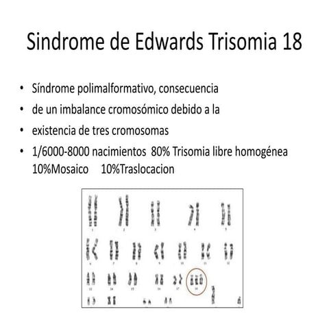 Sindrome de edwards trisomia 18 | PPTX