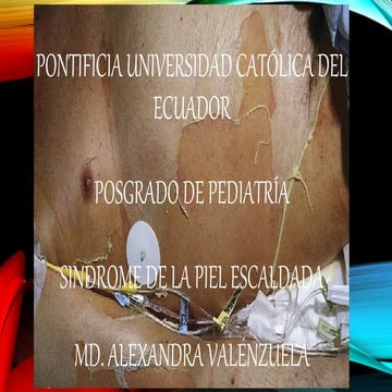 Sindrome de la piel escaldada por estafilococo | PPTX