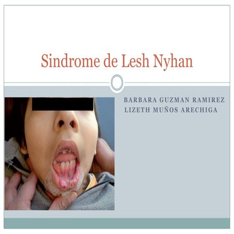Lesch–nyhan syndrome | PPTX