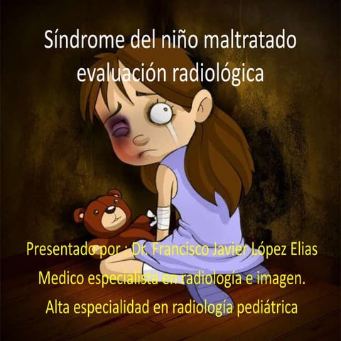 17 SINDROME DEL NIÑO MALTRATADO.ppt SINDROME DEL NIÑO MALTRATADO ...