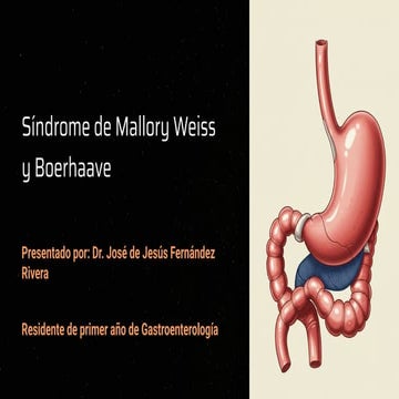 Síndrome de Mallory Weiss | PDF