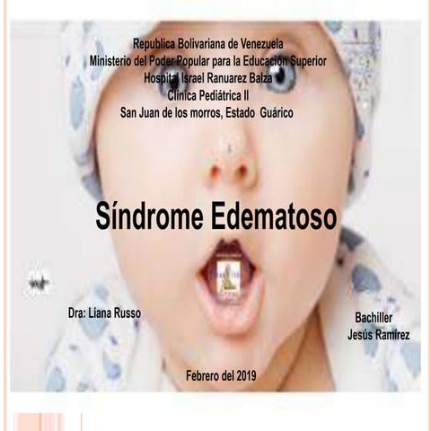 Sindrome Edematoso | PPTX