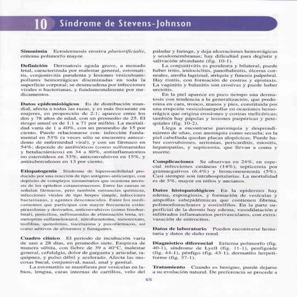 Sindrome stevens johnson | PDF