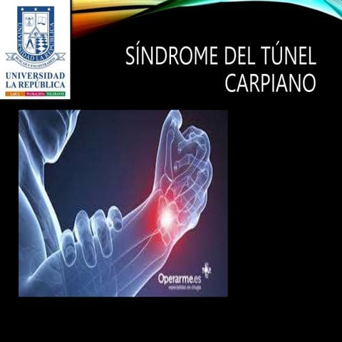 TUNEL CARPIANO ----------------------------------------- | PPTX