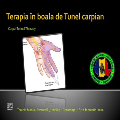 Sindromul de tunel carpian | PPTX