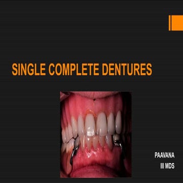Single complete dentures | PPTX