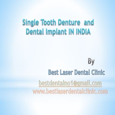 Single tooth denture and dental implant in india | PPTX