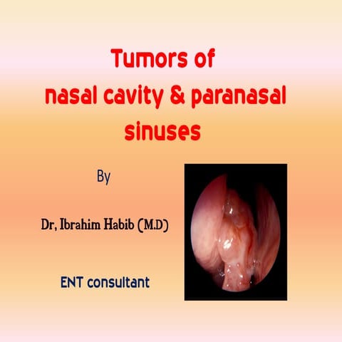 Antral Puncture and Sinus Lavage (Washout).pptx