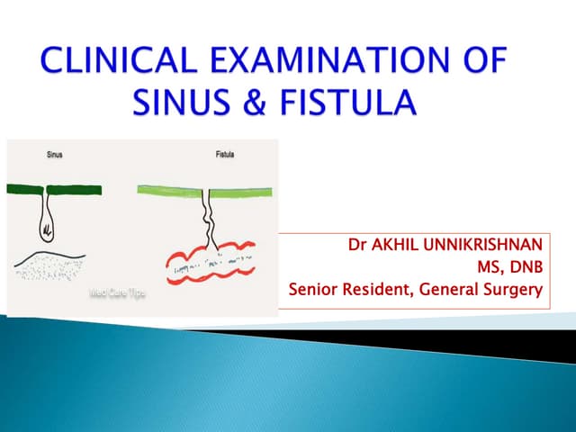 Sinogram and fistulogram | PPTX