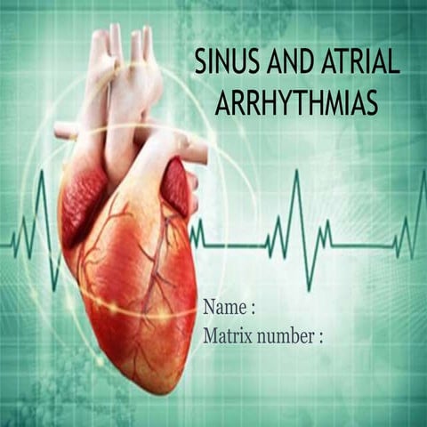 Sinus and atrial arrhythmias | PPTX