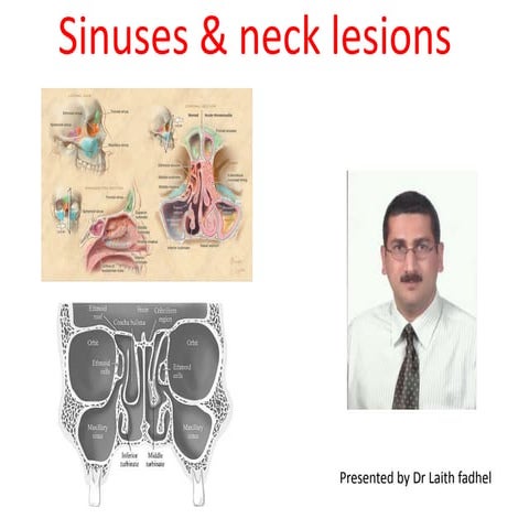 Sinuses & neck lesions | PPTX