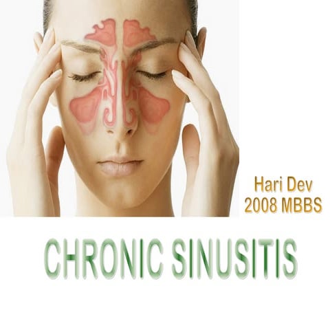 Sinusitis | PPT