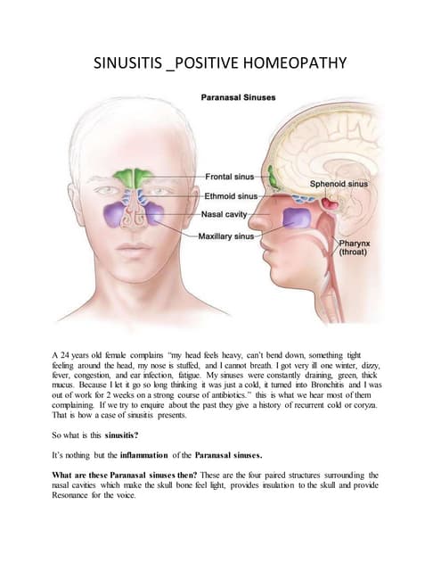 Sinusitis.ppt