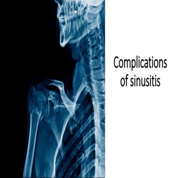 different complications of sinusitis.pptx