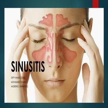 SINUSITIS-2NEW-1.pptx. Management of sinusitis | PPTX