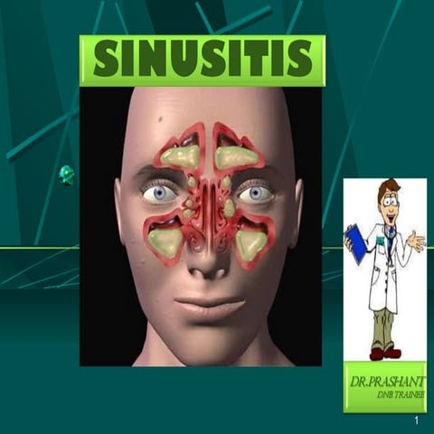 Sinusitis.. Dr.Prashant Modi | PPT