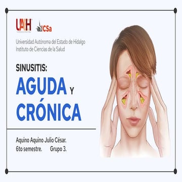 Sinusitis aguda y crónica.pdf