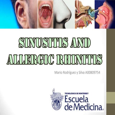 Rhinitis and Sinusitis | DOCX