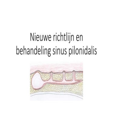 Sinus pilonidalis lokale behandeling en nieuwe richtlijn | PPT