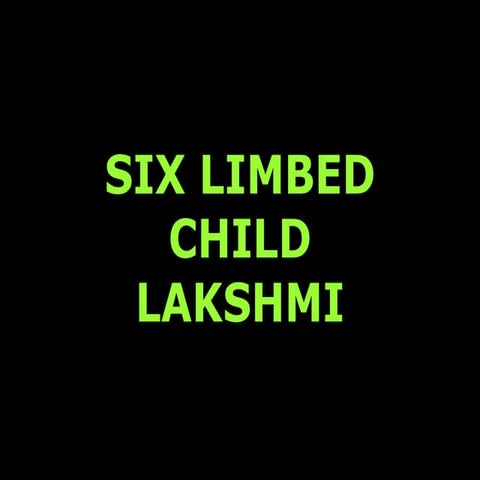 Six limbed child lakshmi | PPT