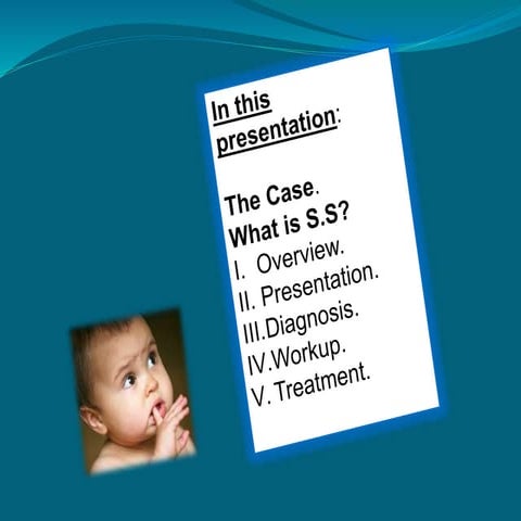 Sjogrens Syndrome - Clinical features, diagnosis and management | PPTX