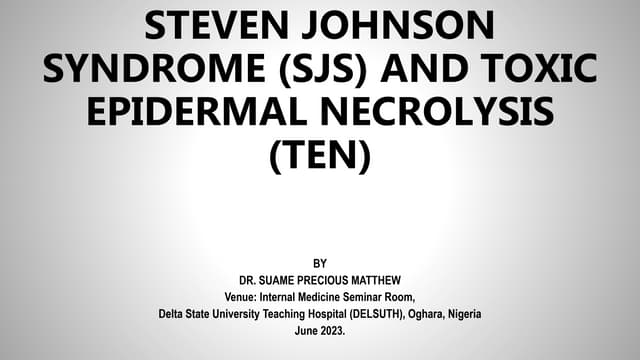 steven johnson syndrome | PPTX