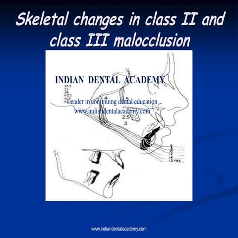 Skeletal changes in cl.ii & cl.iii /certified fixed orthodontic courses ...
