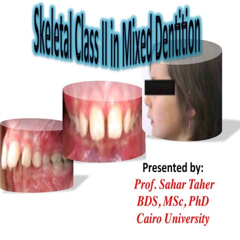Skeletal Class II - Mixed Dentition, By Prof. Sahar Taher | PDF