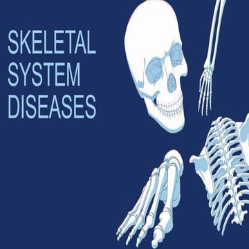 Skeletal System Diseases.pptx (For educational purposes only) | PPT