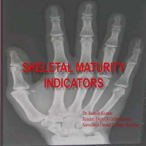 Hand Wrist Radiography | PPTX