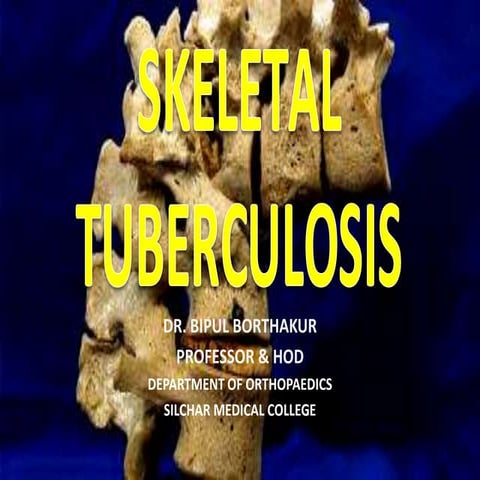 Skeletal tuberculosis | PPTX