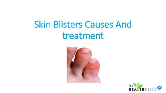 Blisters | PPT