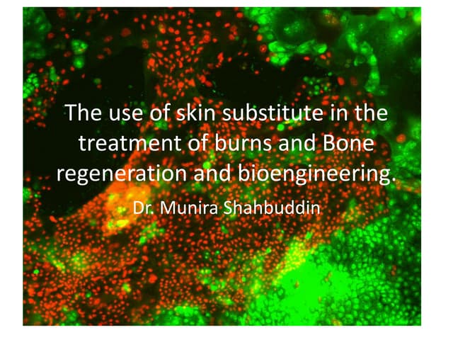 Tissue Engineering of the Skin.ppt