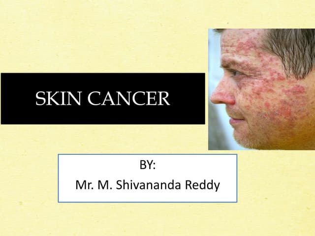 Basal cell carcinoma | PPTX