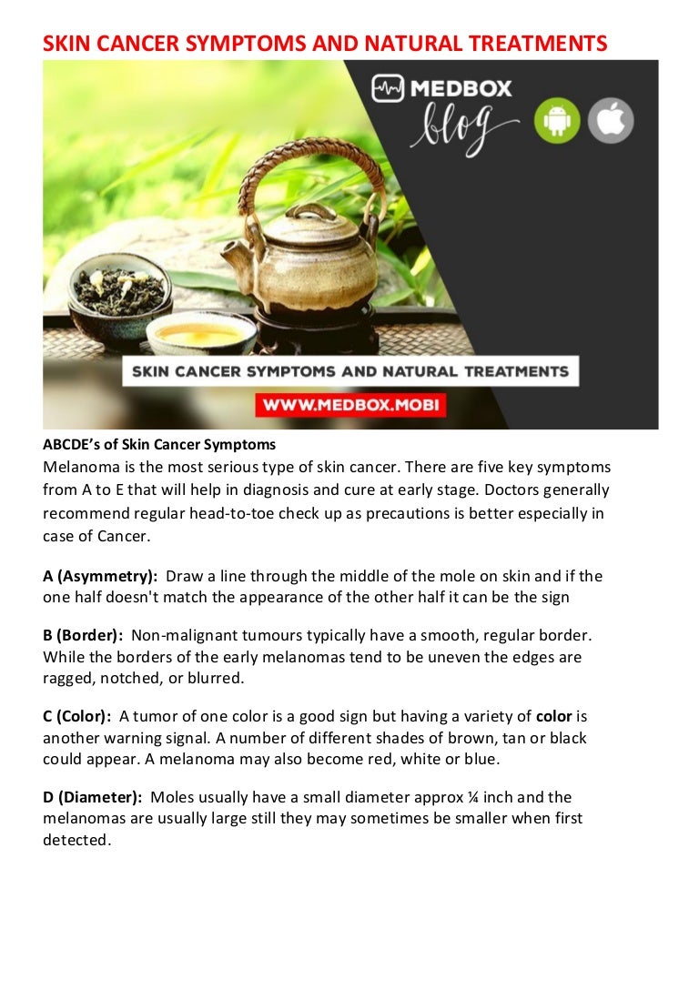 Skin Cancer Symptoms And Natural Treatments
