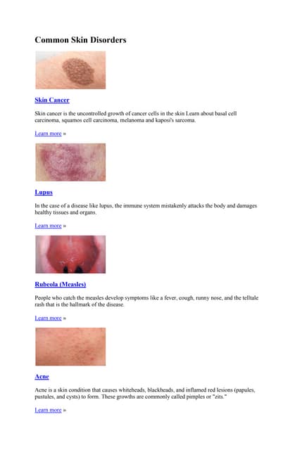Common Skin Diseases | PPT