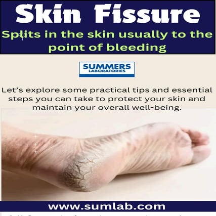 How do you heal a skin fissure fast? | skin fissure | PDF