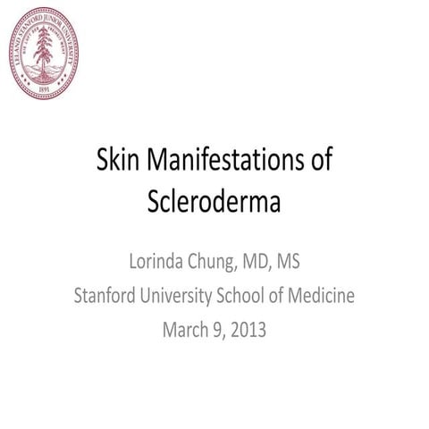 Skin Manifestations of Scleroderma, by Dr. Lorinda Chung MD | PPTX