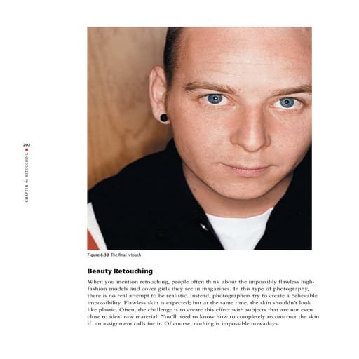 Skin Varis 202 215 | PDF