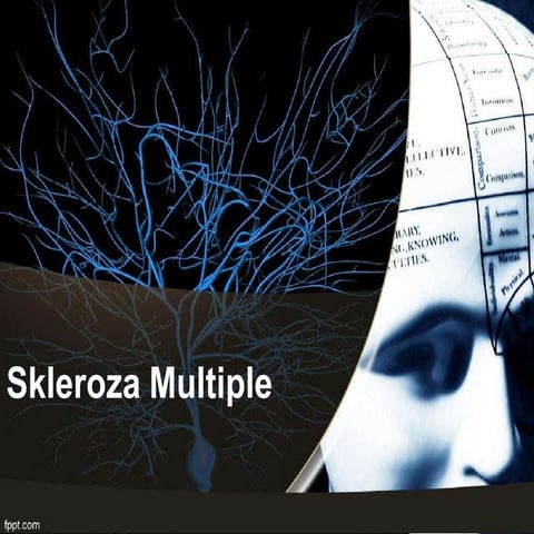 Skleroza_Multiple (1).pptx