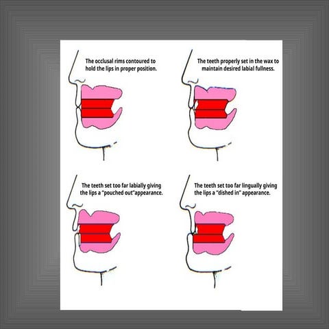 9. anterior teeth arrangement | PPT