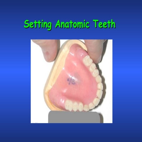 tooth arrangement for preclinical prosthodontics | PPT