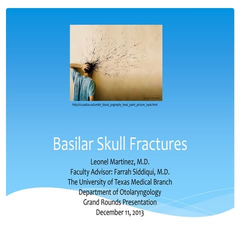 Skull Base fractures ( PDFDrive ).pdf